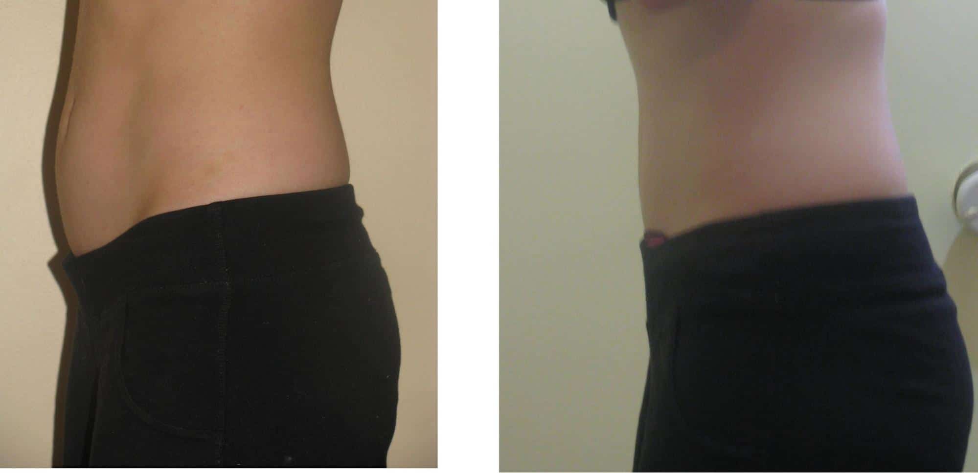 Belly Fat Exercises (How to Flatten Your Midsection) - Optimal Body ...